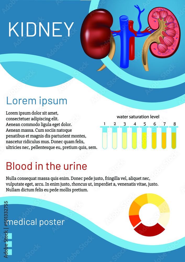 medical poster with kidneys. Urine color chart. Printable brochure ...