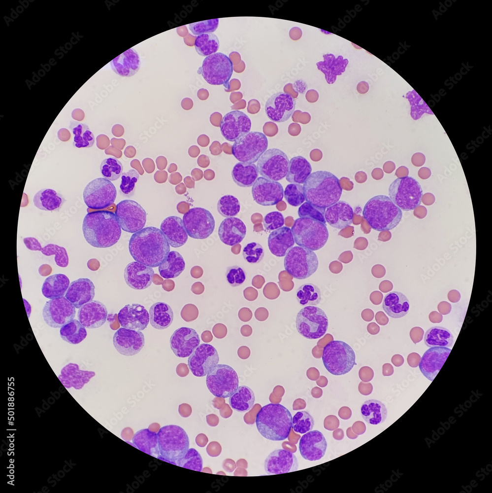 Microscopic images are acquired from blood smears of patients with ...