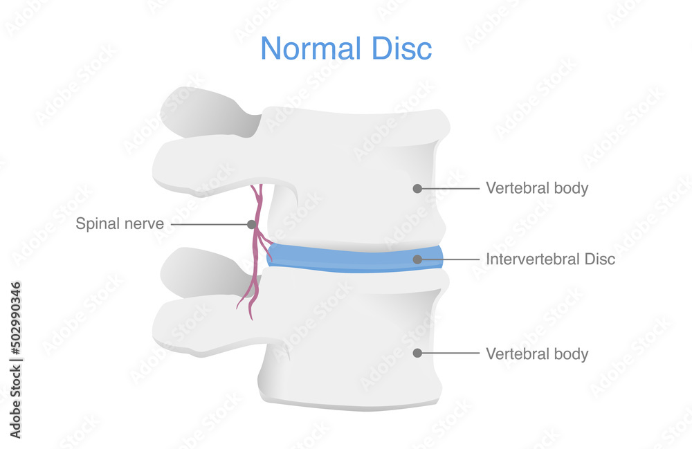 Anatomy of normal human Disc. Illustration of Medical diagram about the ...
