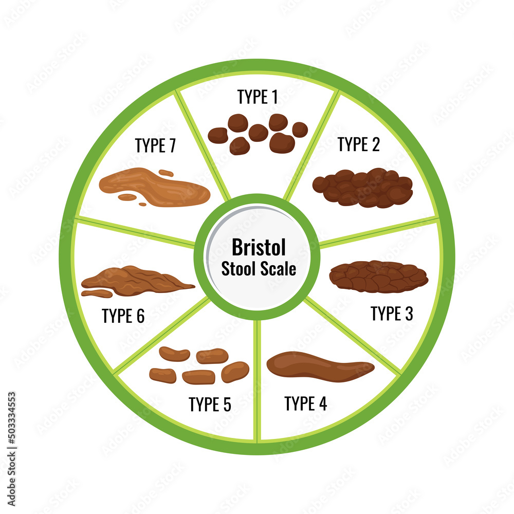 Bristol stool chart with faesces classification. Different type of poop ...
