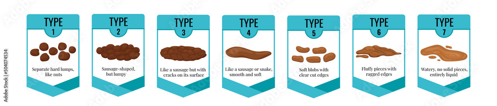 Bristol stool chart with faesces type classification. Different form ...