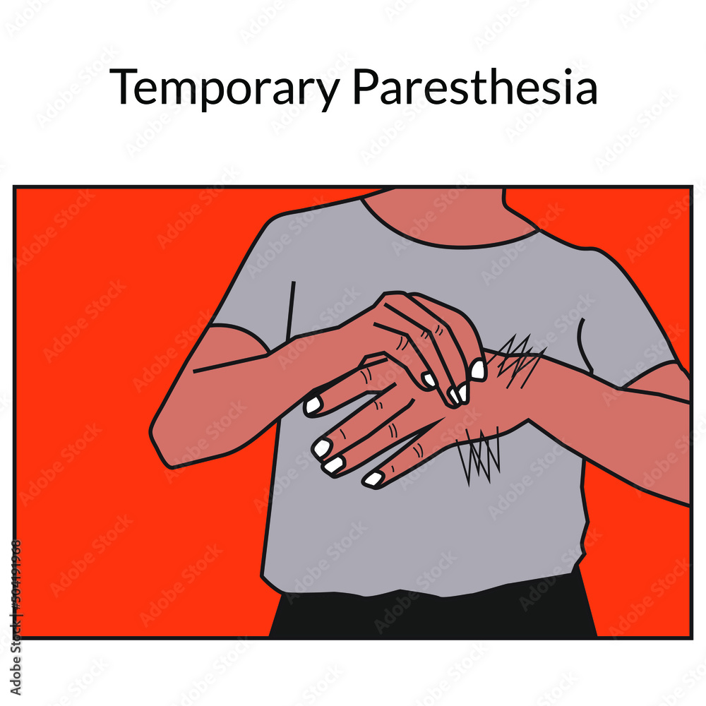 Paresthesia stock illustration. The vector image relates to a burning ...