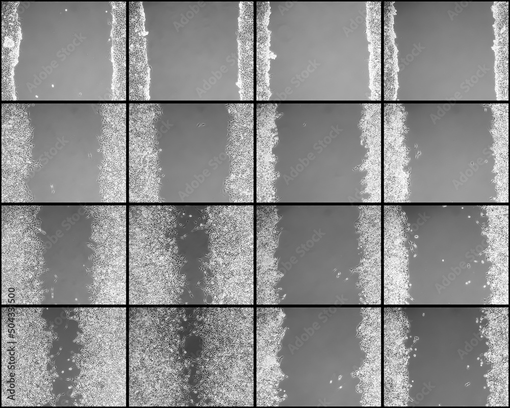 Sequential images of in vitro wound healing (scratch assay) performed ...