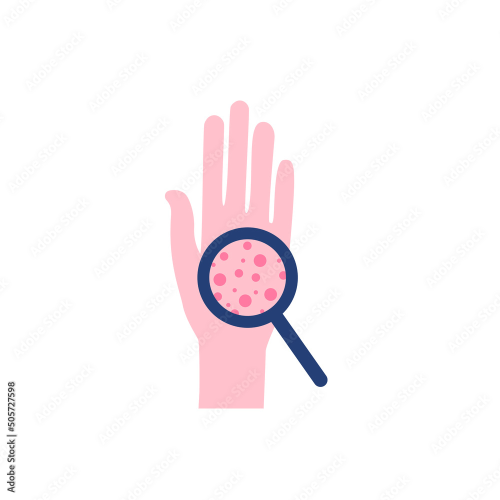 Contact dermatitis flat design long shadow color icon. Skin redness ...
