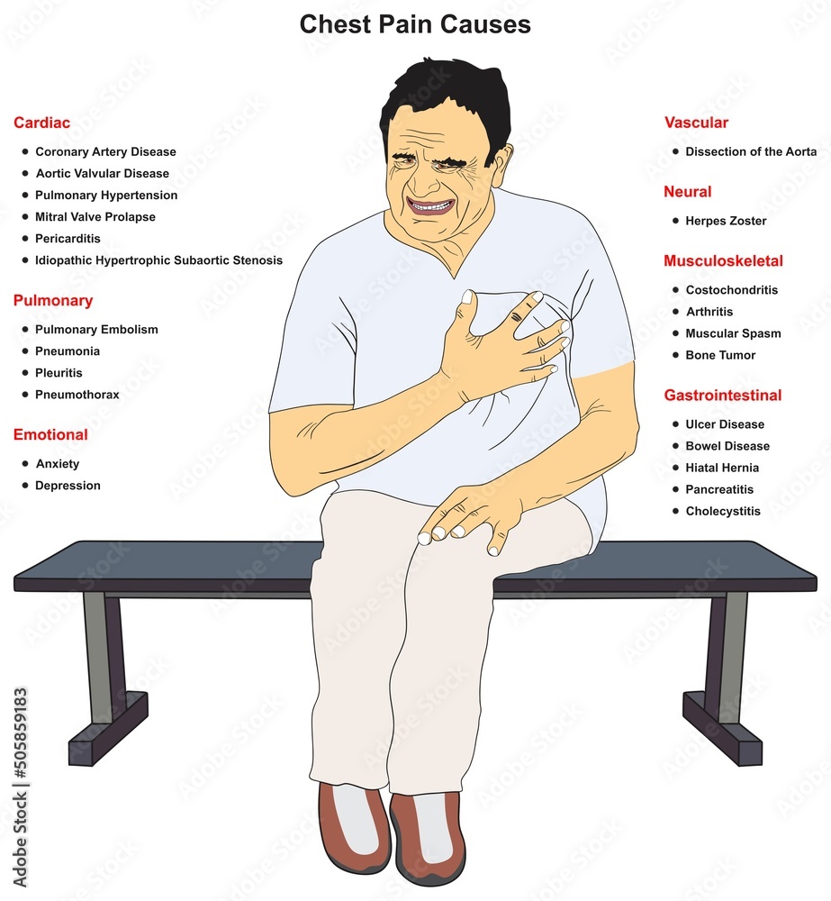 Vector de Stock Chest pain causes infographic diagram for medical ...