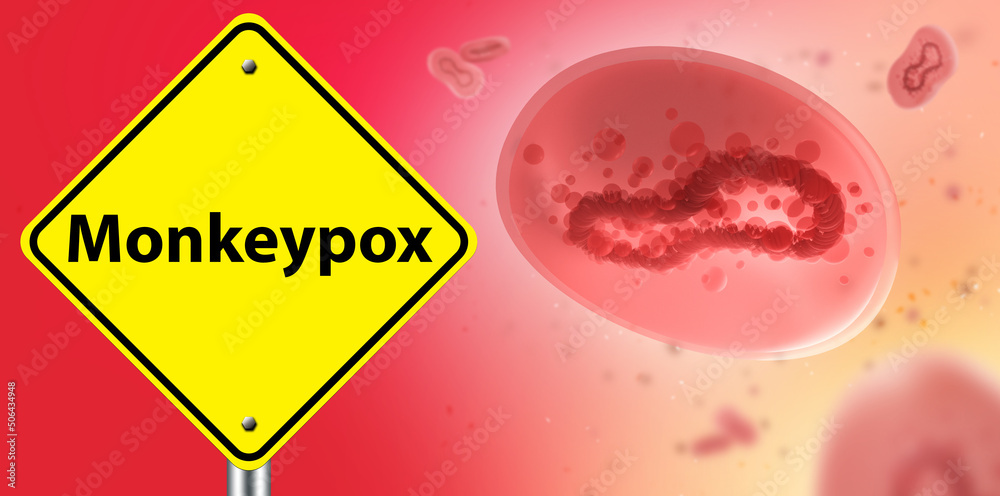 Monkeypox warning. Molecules of dangerous virus in body. Monkeypox ...