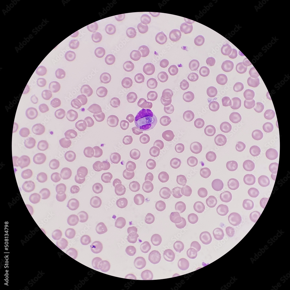 Detection of intracellular Hepatozoon canis gamonts in neutrophils and ...
