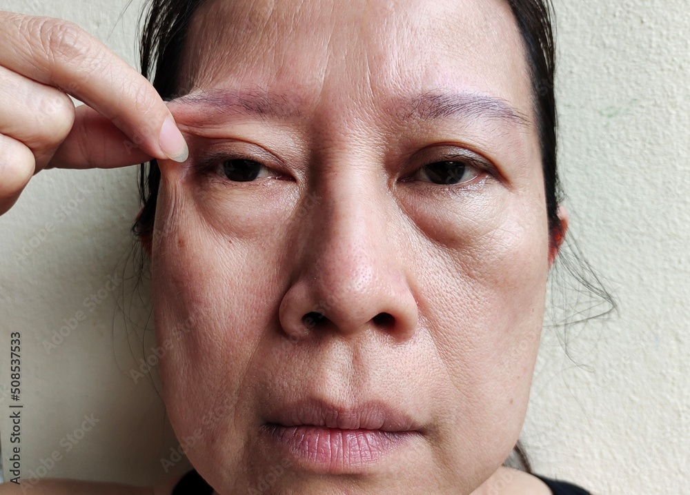 Portrait showing the fingers squeezing flabbiness adipose beside the ...