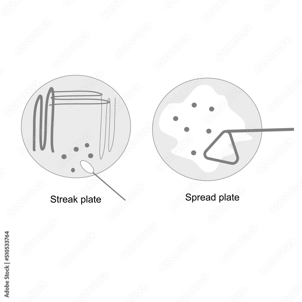 The pure culture technique: Streak and Spread plate with sterilize loop ...