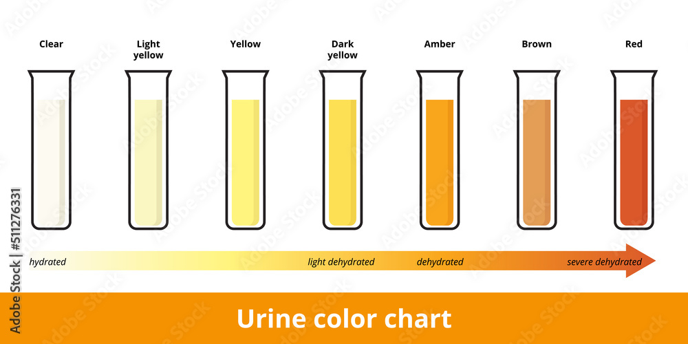 Urine color chart. Pee hydration and dehydration test strip. Urine in ...