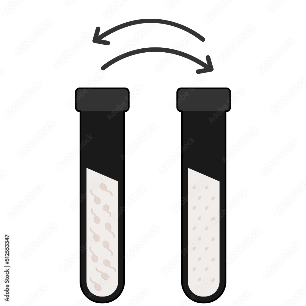 test tube baby procedure stock illustration, Sperm and Eggs in ...