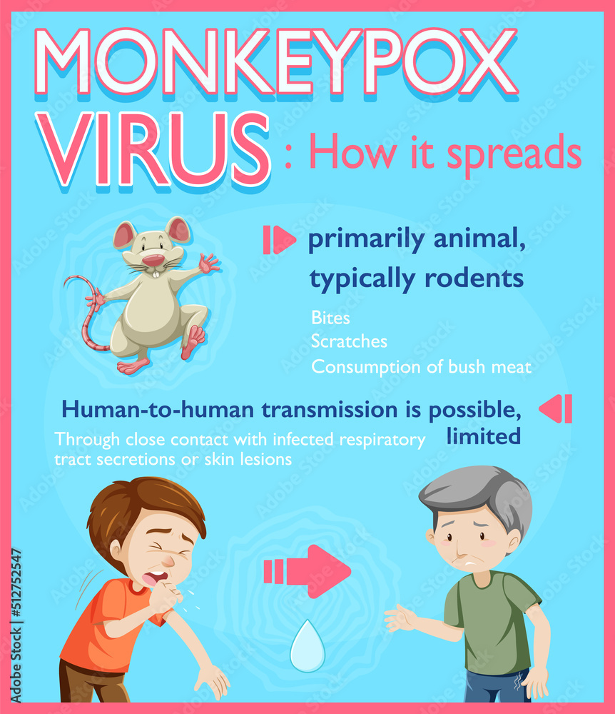 Monkeypox virus symptoms infographic Stock Vector | Adobe Stock