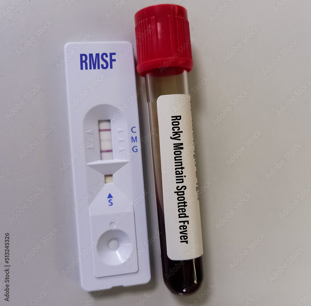 Foto de Stock Blood sample and rapid test device for Rocky Mountain ...