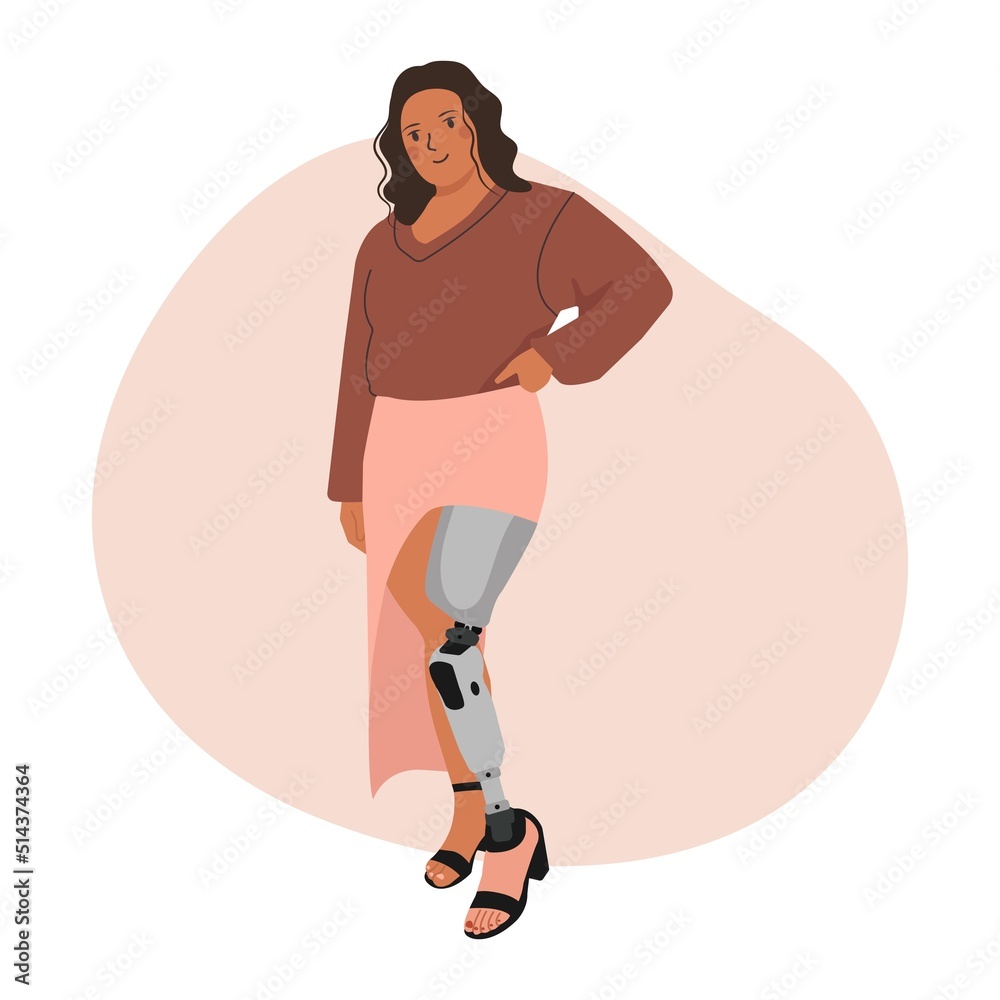 Cute girl with a Prosthetic Leg. Bionic Leg, Prosthesis limb. People ...