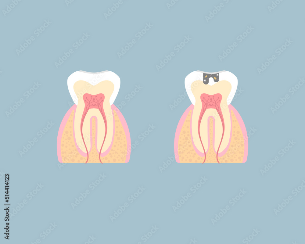 Stock-Vektorgrafik „dental teeth care, internal organs, tooth anatomy ...