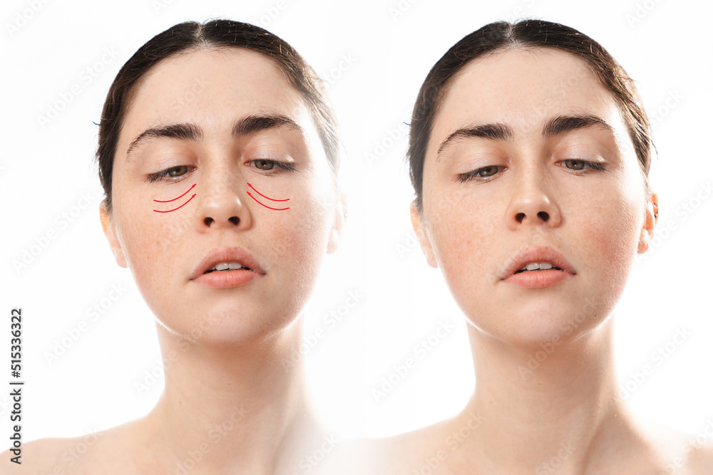 Two face of a caucasian woman looking at her nose, isolated on a white ...