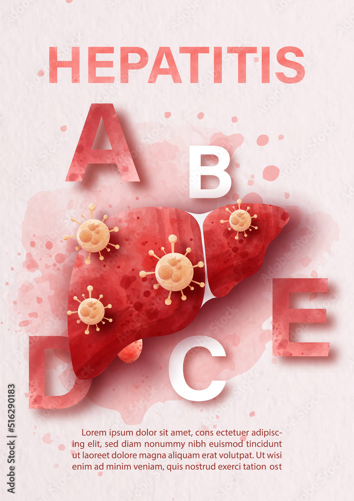 Human liver with English letters in Concept of hepatitis A, B, C, D ...