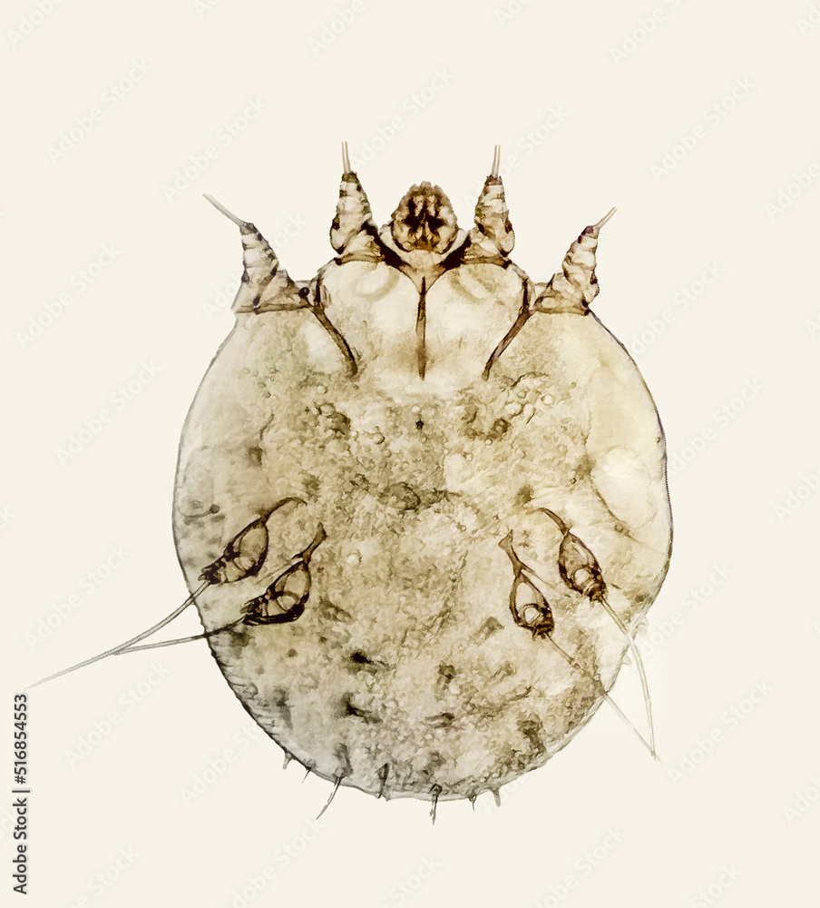 Sarcoptes scabiei or the itch mite, parasitic microorganism of human ...