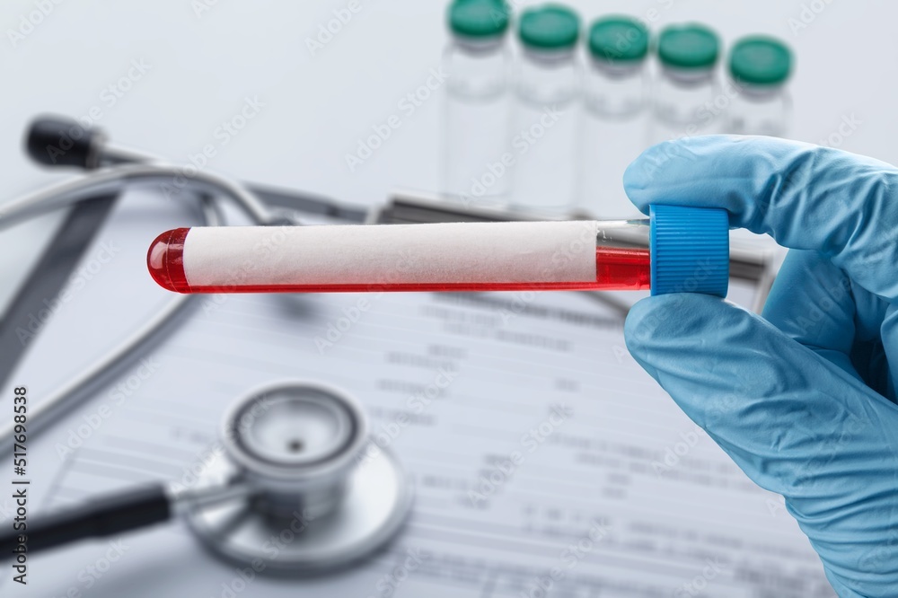 Blood sample tube for analysis Test. Blood tube test with requisition ...