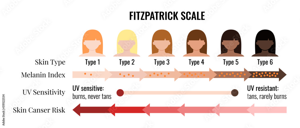 Fitzpatrick skin tone scale phototype melanin index with female avatar ...