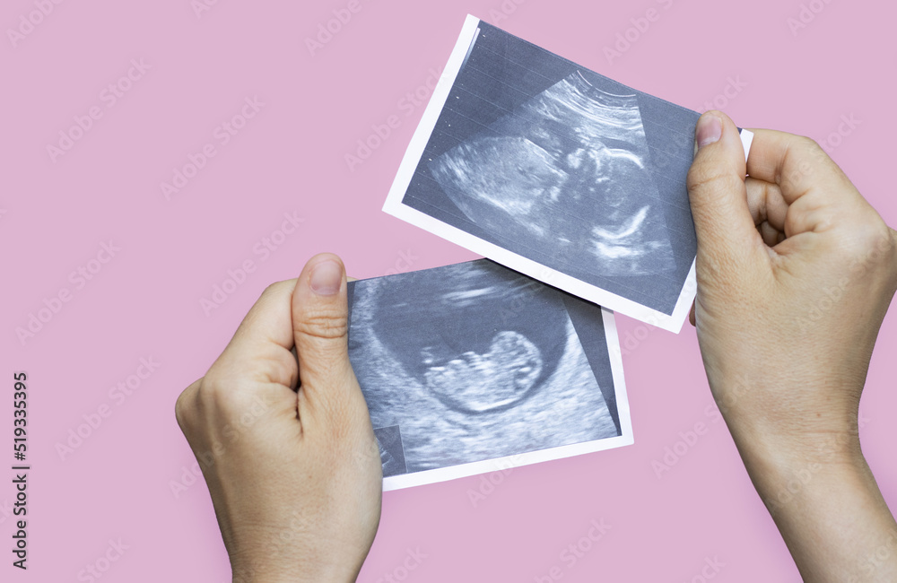 pregnancy and baby waiting. ultrasound picture with fetus in uterus in ...