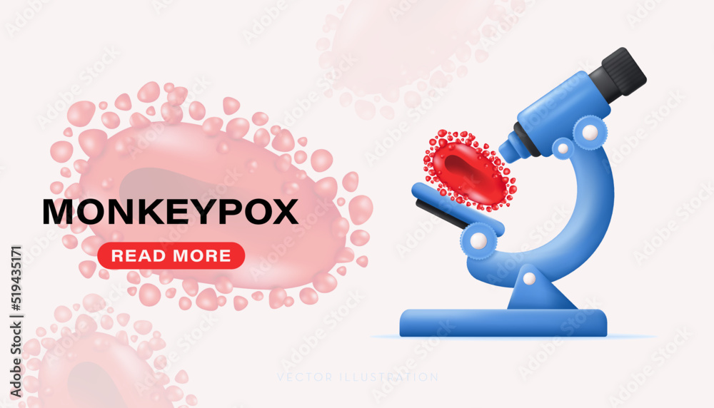 Monkeypox on microscope. Monkeypox virus outbreak concept, monkeypox ...