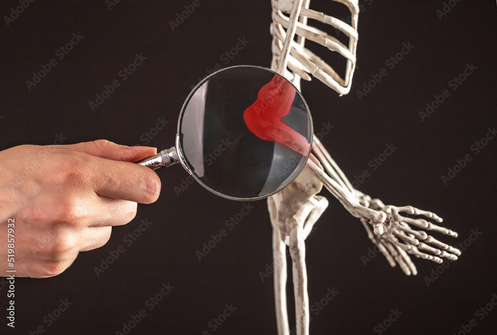 Hand with magnifying glass over elbow bones of human skeleton with red ...