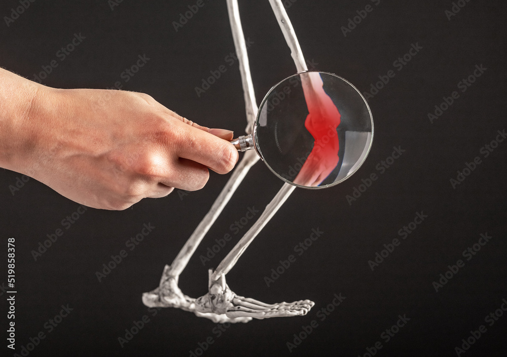 Hand with magnifying glass over patella of human skeleton with red spot ...