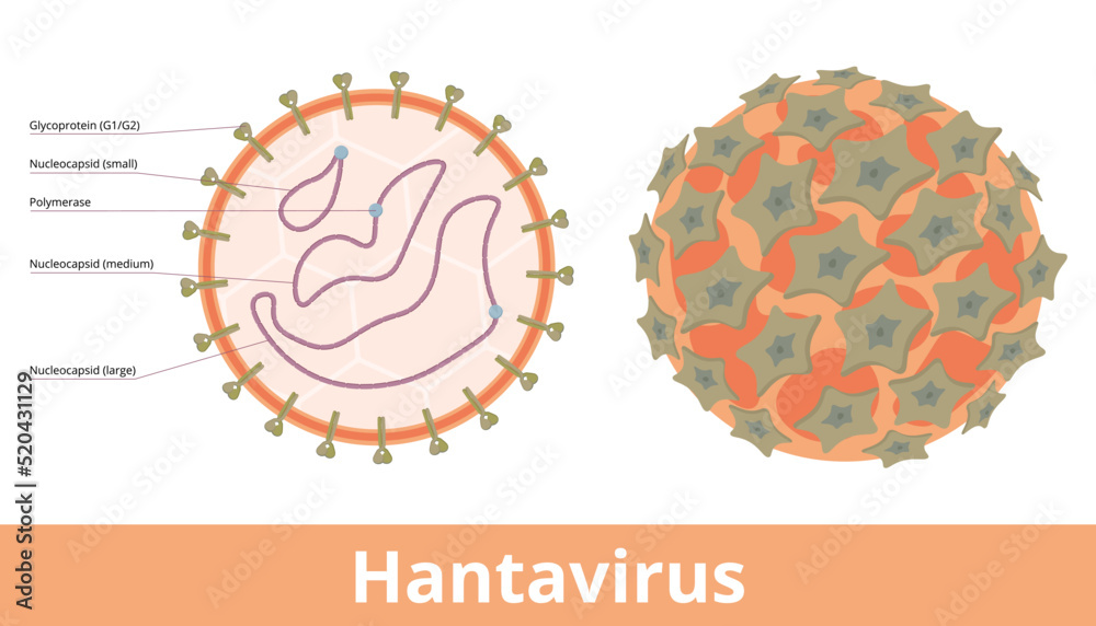Orthohantavirus. Hantavirus infections in humans are associated with ...