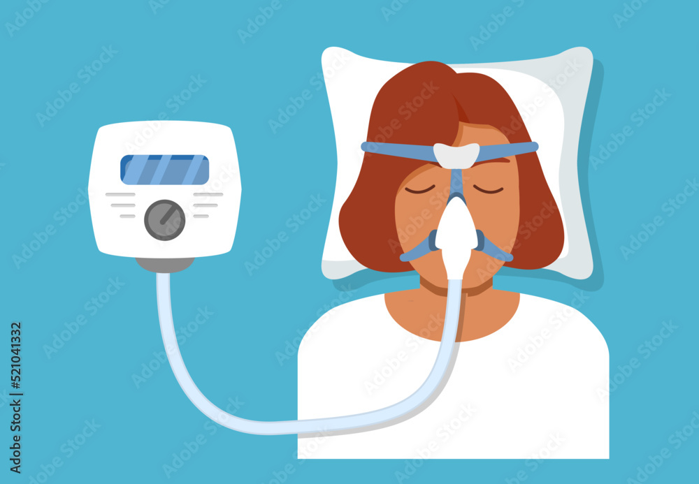 Vector de Stock Continuous positive airway pressure.Obstructive sleep ...