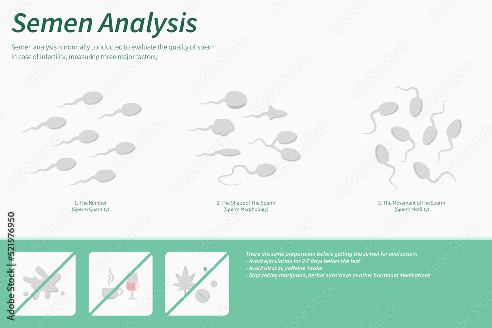 Semen Analysis horizontal infographic.ai horizontal infographic illustration about infertine ...