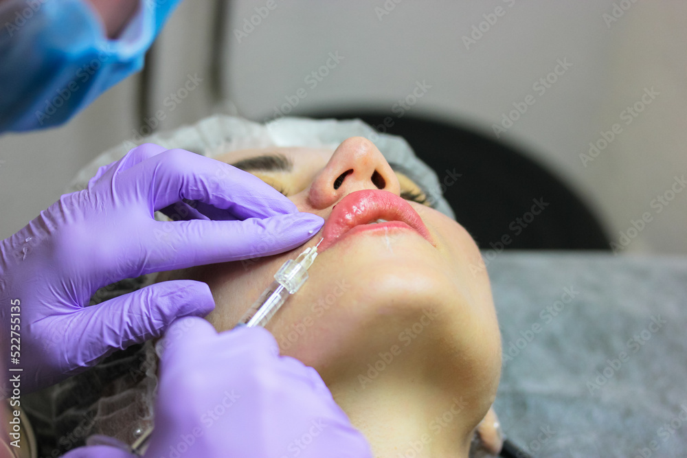 Lip augmentation procedure. A patient woman getting filler injection ...
