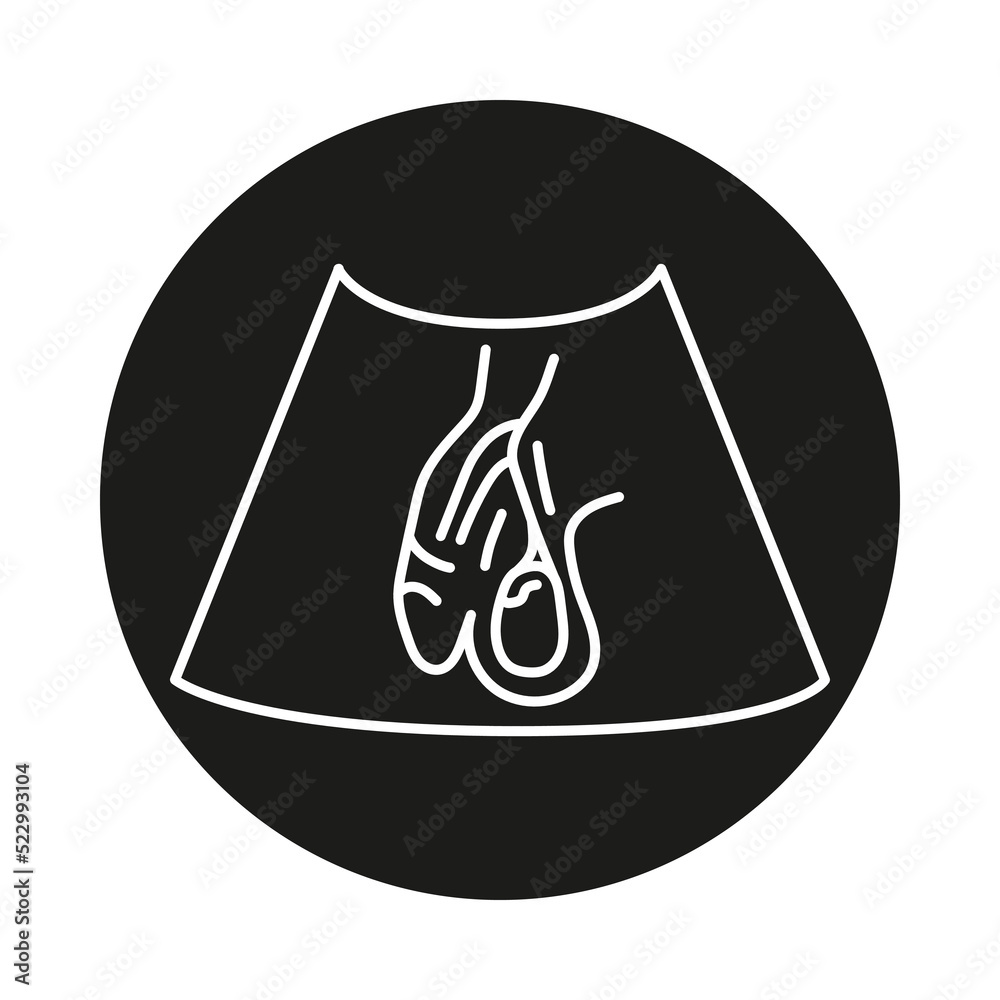 Ultrasound male reproductive system color line illustration Stock ...