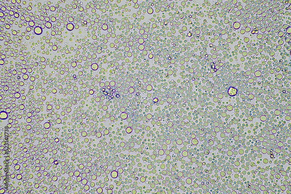 person with a virus coughing, Phlegm and mucus under the microscope ...