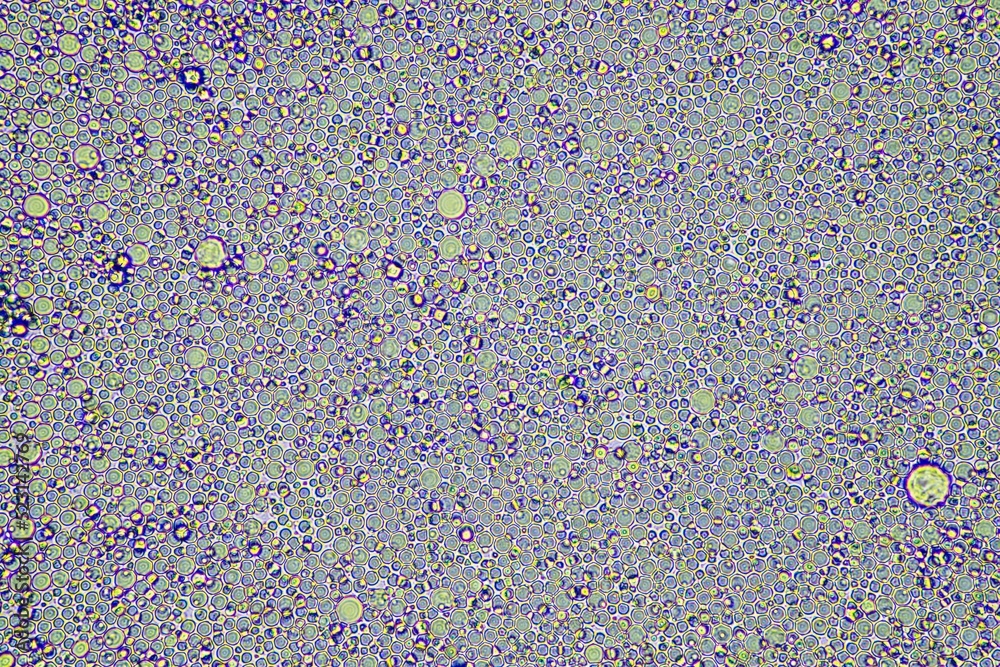 person with a virus coughing, Phlegm and mucus under the microscope 素材庫 ...