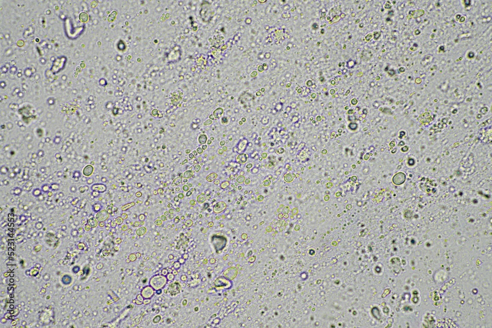 coughing, Phlegm and mucus under the microscope Stock Photo | Adobe Stock