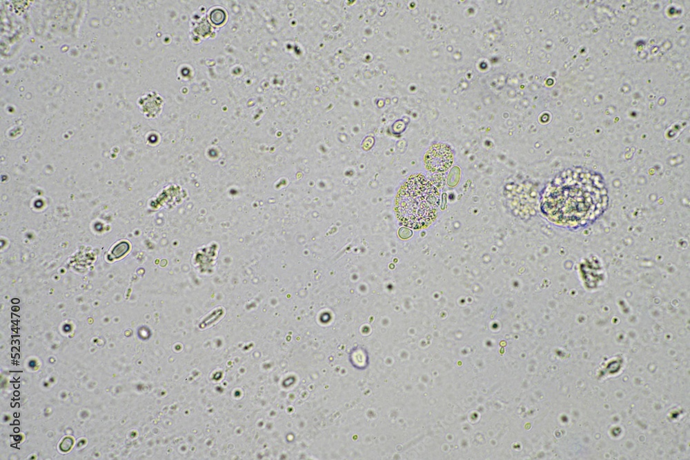 coughing, Phlegm and mucus under the microscope 素材庫相片 | Adobe Stock