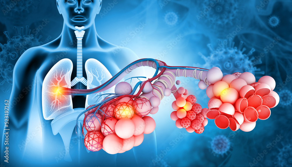 Alveoli in lungs. tiny air spaces in the lungs through which exchanges ...