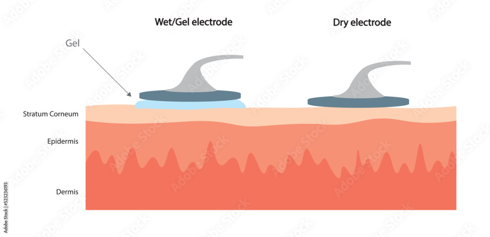 Diference from Wet and Gel electrode and a Dry electrode for monitoring ...