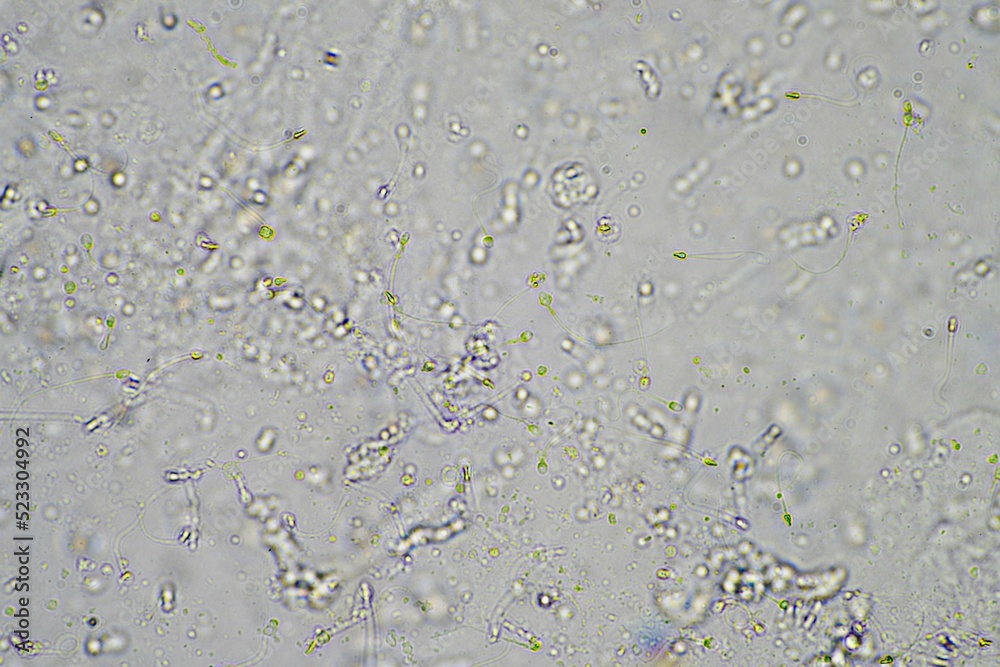 Sperm under the microscope. Looking a semen swimming. Healthy fertile ...
