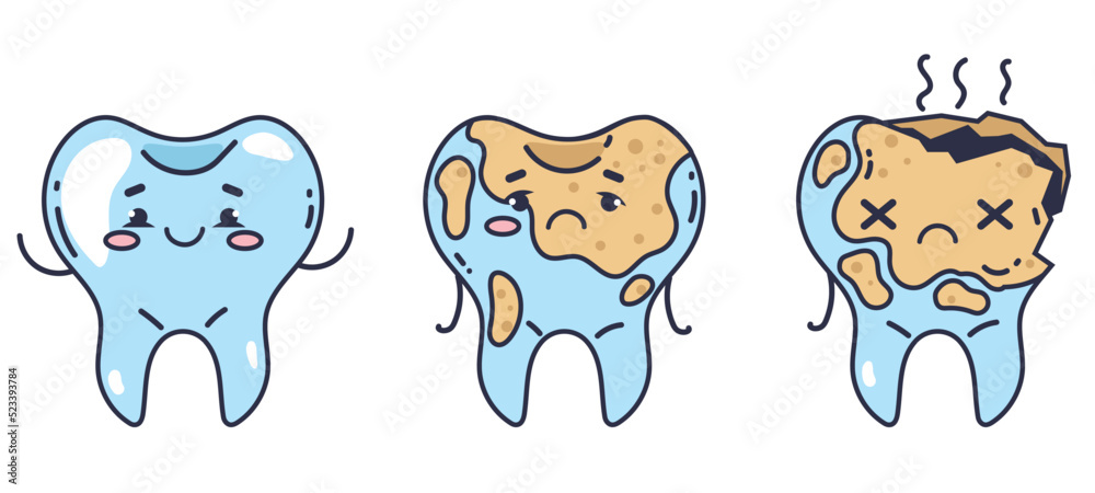 Caries tooth stage steps cavity teeth decay dental abscess line art ...