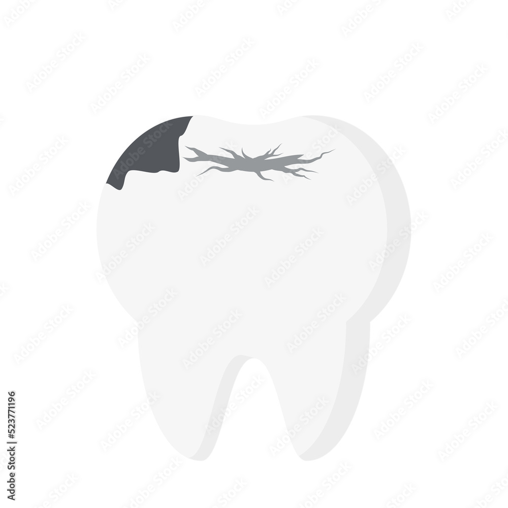 Tooth Broken Cavity Cracked Teeth Stock Illustration | Adobe Stock