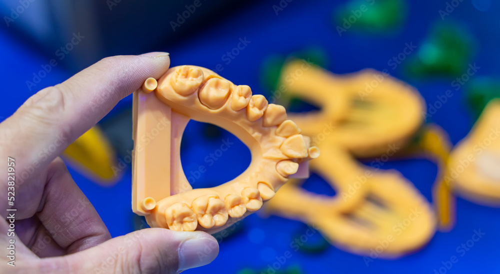 Dental technician modeling teeth frame for implant production from a 3d ...