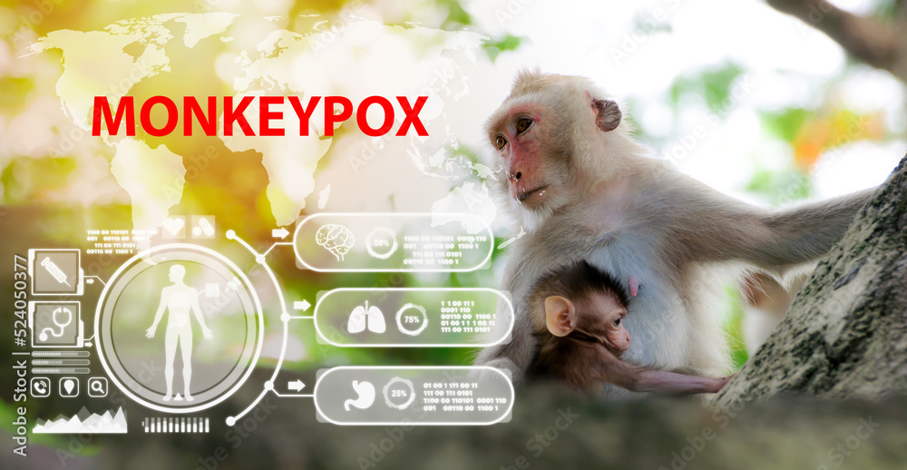 Foto de Stock Monkeypox new disease dangerous. Symptom monkeypox cell ...