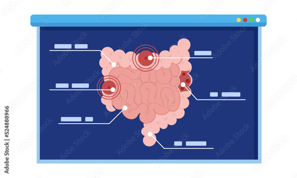 Large intestine Diagram with explaining. explain anatomy for lecture ...