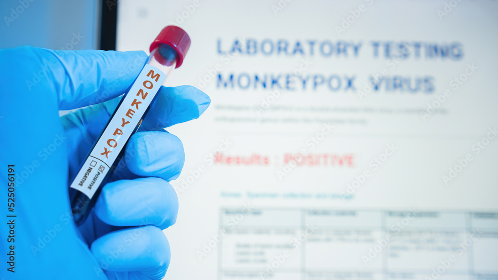 Photo Stock hand holding blood collection tubes and data sheet on ...
