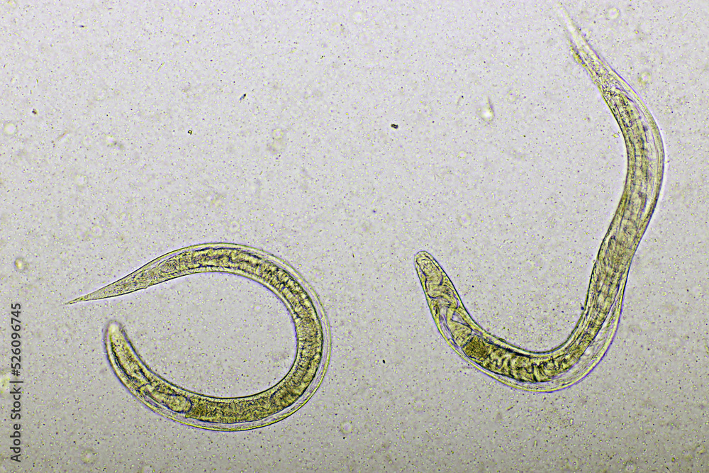 Strongyloides stercoralis or threadworm in human stool, analyze by ...