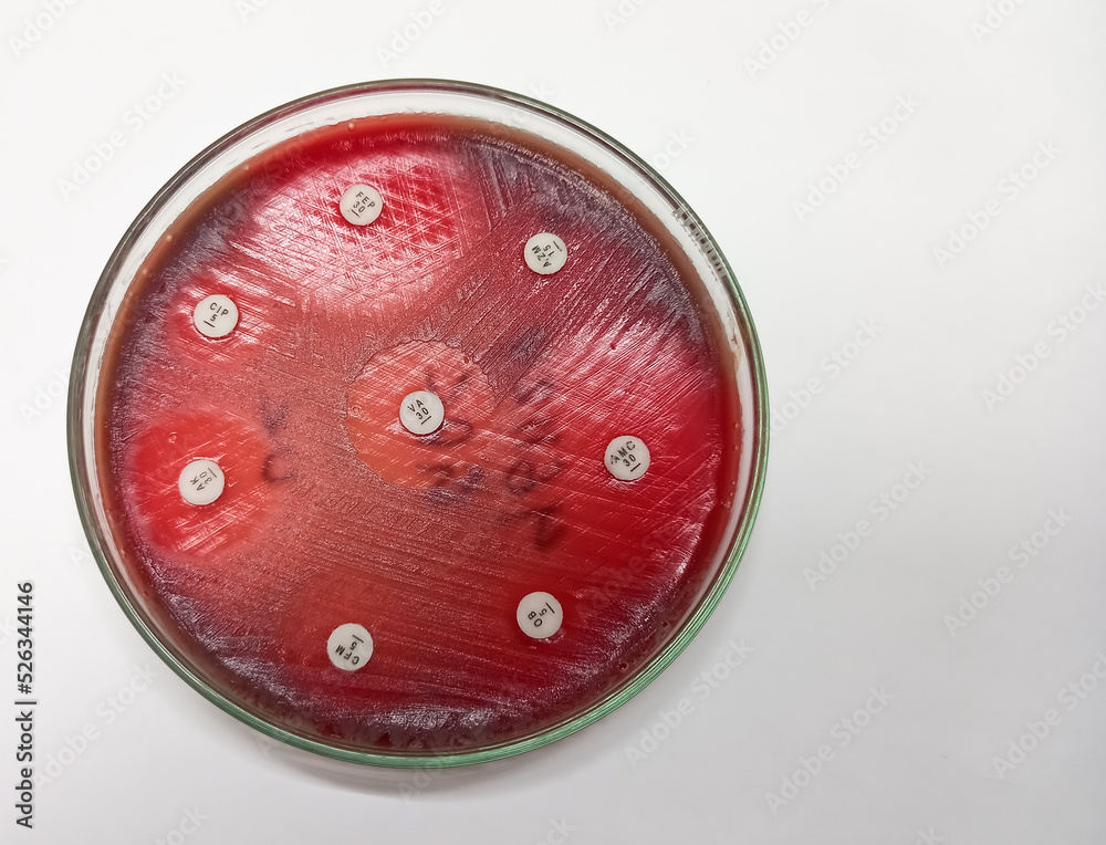 Antimicrobial susceptibility testing in petri dish. Antibiotic ...