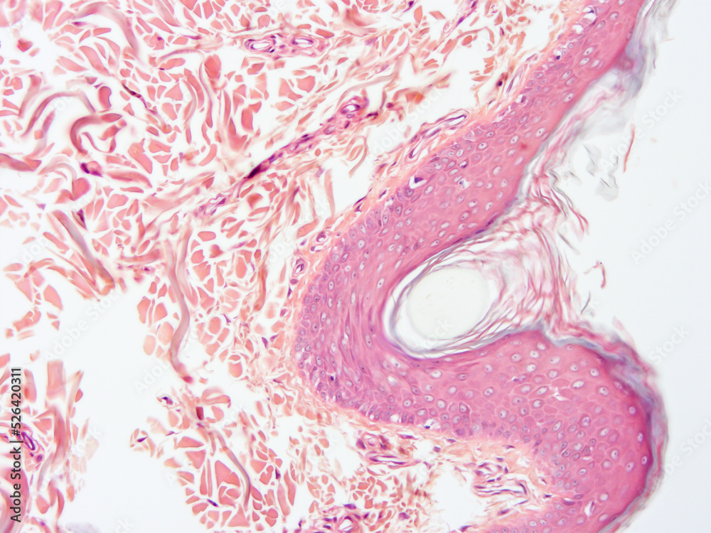 Histology of human tissue, show epithelial tissue and connective tissue ...