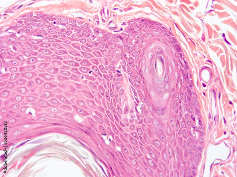 Histology of human tissue, show epithelial tissue and connective tissue ...